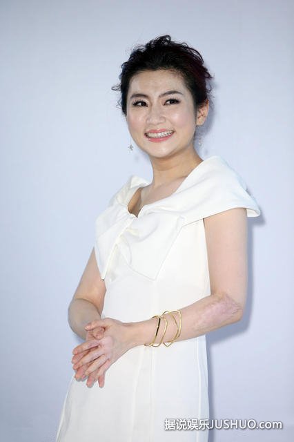 Selina着白裙代言护肤品 露手臂伤疤但依旧自信